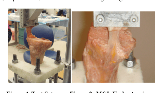 [PDF] Is Pie-Crusting as Safe as the Traditional Technique of Medial ...