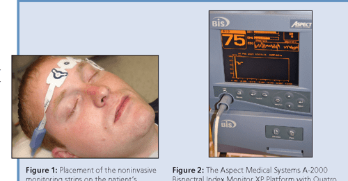 [PDF] Use of bispectral index system (BIS) to Monitor Enteral Conscious ...