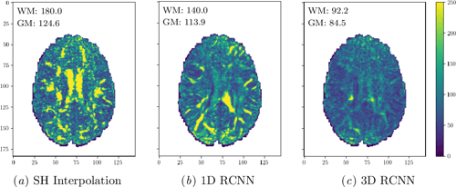 Figure A.1 from Angular Super-Resolution in Diffusion MRI with a 3D ...