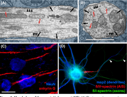 [PDF] The Axon Initial Segment, 50Years Later: A Nexus for Neuronal Organization and Function ...
