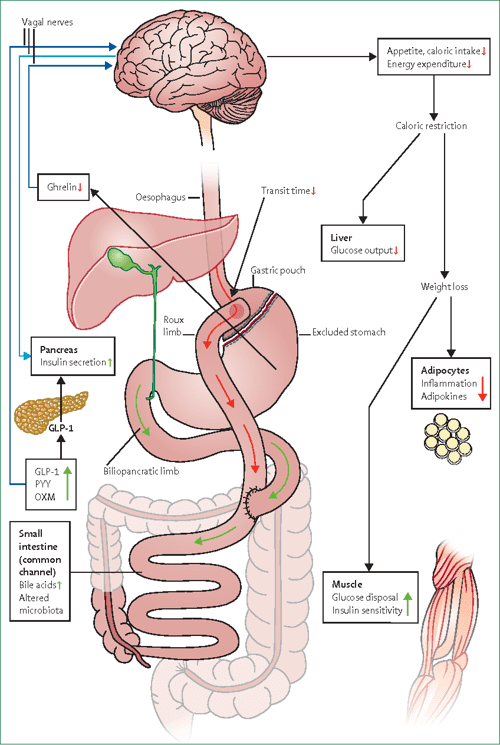 Mechanisms of changes in glucose metabolism and bodyweight after ...