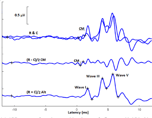 Table 1-1 from Cochlear microphonics from auditory brainstem responses ...