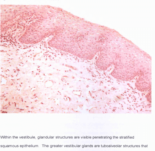 Figure 1.1 from Vulval Vestibulitis Syndrome. | Semantic Scholar