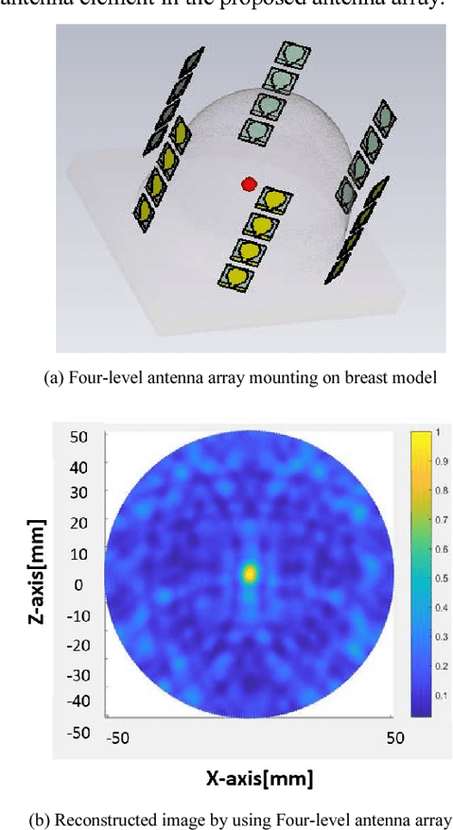 Table III from Breast cancer detection with microwave imaging system ...