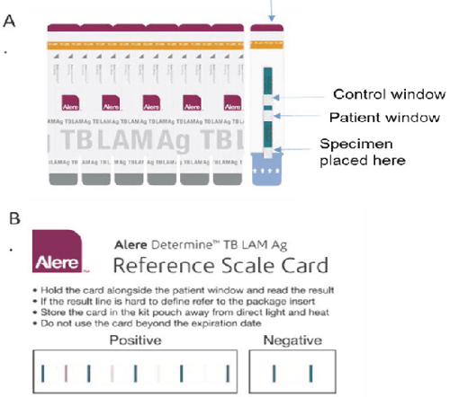 Figure 1 from Lateral flow urine lipoarabinomannan assay (LF-LAM) for ...