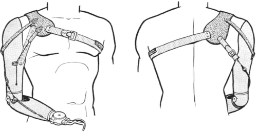 Figure 8 from Harness patterns for upper-extremity prostheses ...
