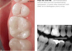 [PDF] Deep Margin Elevation: A Paradigm Shift | Semantic Scholar