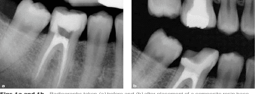 [PDF] Deep Margin Elevation: A Paradigm Shift | Semantic Scholar
