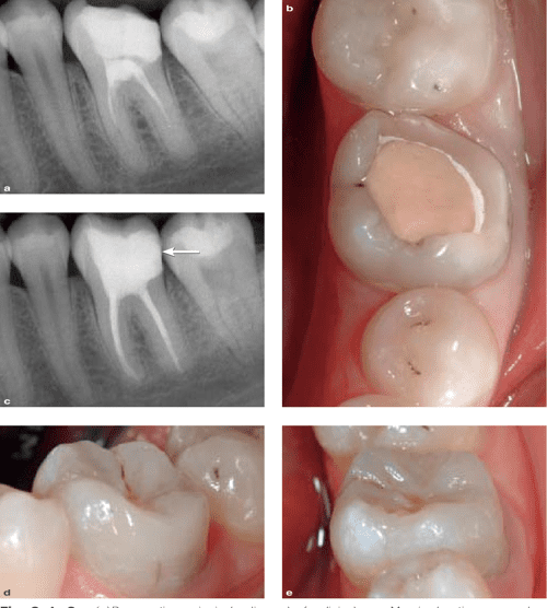 [PDF] Deep Margin Elevation: A Paradigm Shift | Semantic Scholar