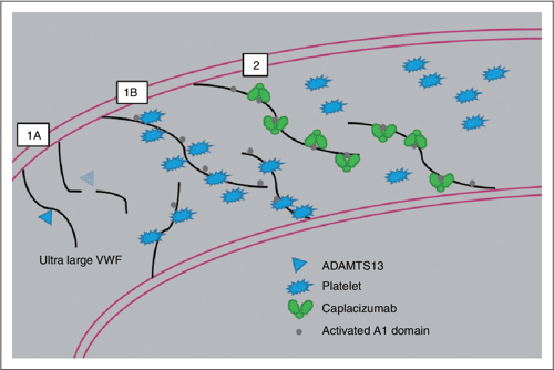 Figure 1 from Role of caplacizumab in the treatment of acquired ...