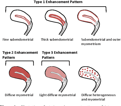 Figure 13 from iliac artery Uterine artery Vaginal arteries Round ...