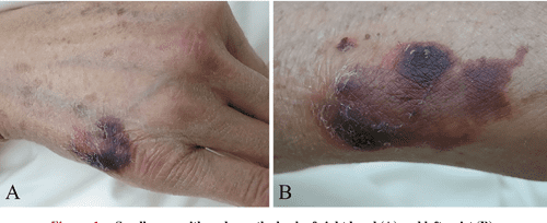 Figure 3 from Sepsis Caused by Newly Identified Capnocytophaga canis ...