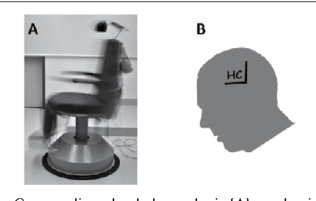 Figure 2 from Clinical Value of Rotational-Chair Testing in Vestibular ...