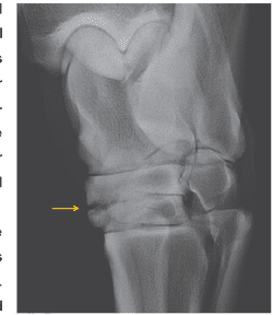 Figure 1 from Radiographic study of bone spavin in Lusitano Horses ...