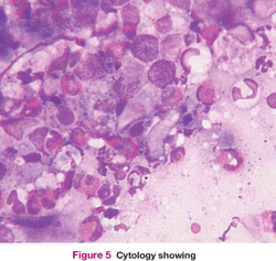 Feline Eosinophilic Granuloma Complex(ITIES) | Semantic Scholar