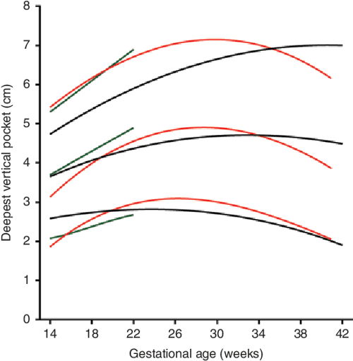 Figure 1 from Reference values for the single deepest vertical pocket ...