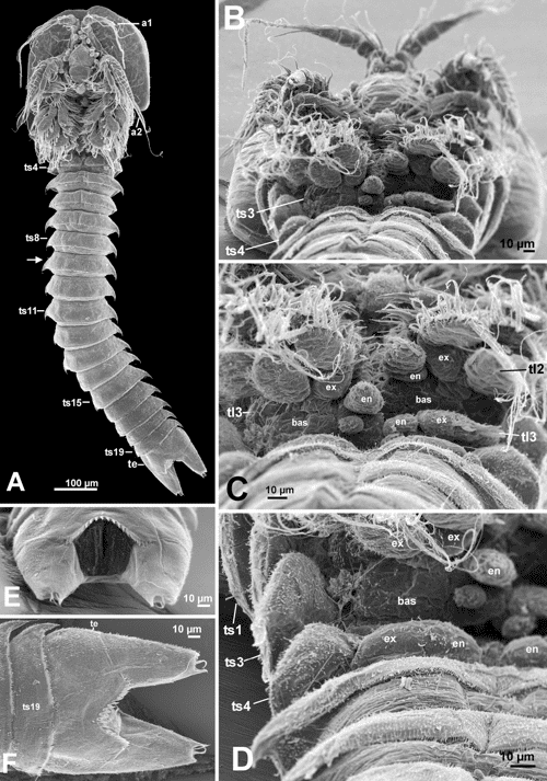 Figure 11 from External morphology of Lightiella monniotae (Crustacea ...