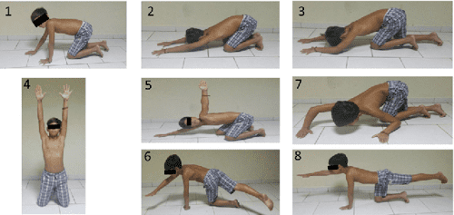 Figure 2 from Klapp method effect on idiopathic scoliosis in ...
