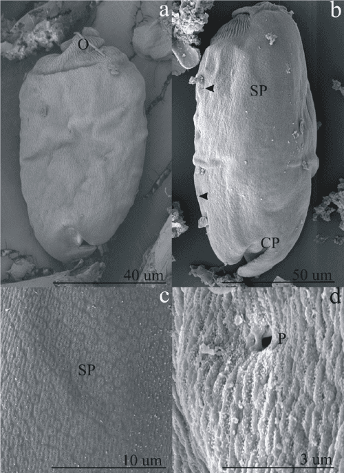 Figure 2 from Rumen ciliates of domestic cattle (Bos taurus taurus) in ...