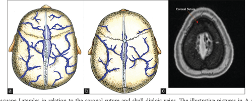 Figure 1 from Magnetic resonance imaging analysis of human skull ...