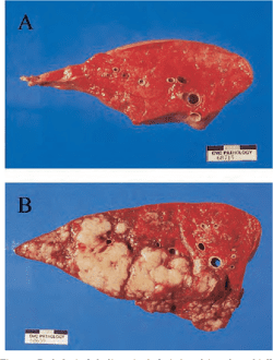 Figure 1 from Rhodococcus equi Pneumonia | Semantic Scholar