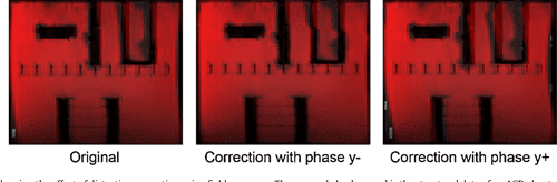 Figure 1 from The first step for neuroimaging data analysis: DICOM to ...