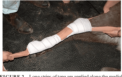 Modified Thomas splint‐cast combination for the management of limb ...