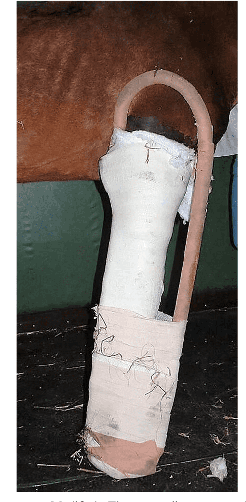 Modified Thomas splint‐cast combination for the management of limb ...