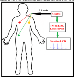 Figure 2 from Design and Implementation of A Low-Cost ECG Monitoring System Using ARM Cortex-M4 ...