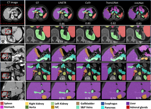 [PDF] UNETR: Transformers for 3D Medical Image Segmentation | Semantic ...