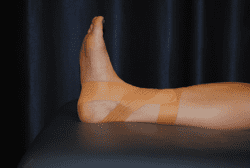 Figure 26 from A Comparison of Two Tape Techniques on Navicular Drop ...