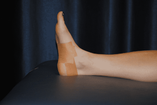 Figure 26 from A Comparison of Two Tape Techniques on Navicular Drop ...