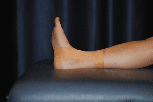 Figure 26 from A Comparison of Two Tape Techniques on Navicular Drop ...