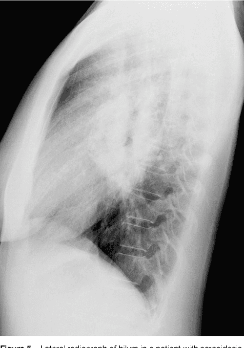 Lateral chest radiograph a systematic approach. | Semantic Scholar
