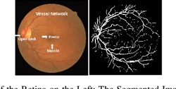Figure 1 from Deepfakes on Retinal Images using GAN | Semantic Scholar