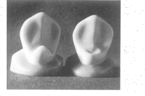 [PDF] Alternative cingulum rest seat. | Semantic Scholar