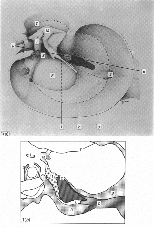 Detailed morphology of the tensor tympani muscle of the rat. An ...