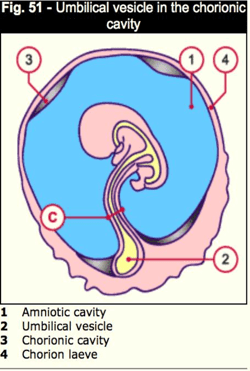 [PDF] Furcate cord insertion of the umbilical cord: pathological and ...