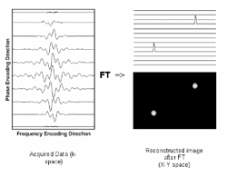 Figure 1.1 from HIGH FREQUENCY TRANSMIT-RECEIVE PHASED ARRAY COIL FOR ...