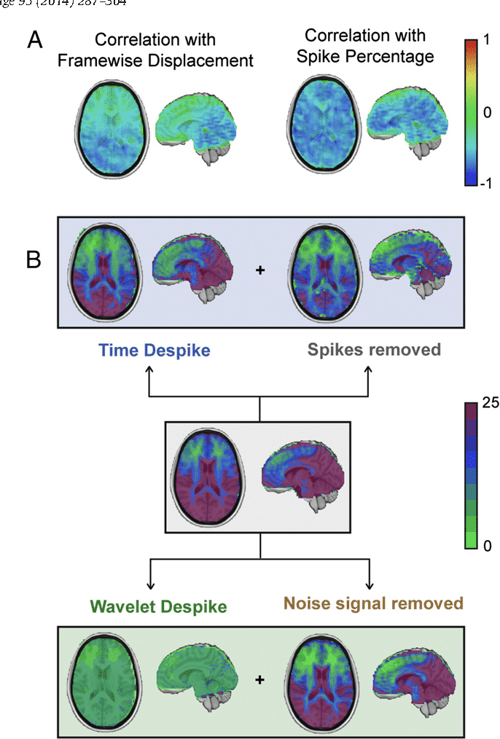 A Wavelet Method For Modeling And Despiking Motion Artifacts From