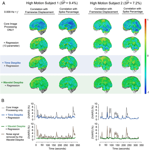 A Wavelet Method For Modeling And Despiking Motion Artifacts From