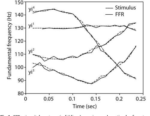 Figure 2 From The Role Of The Auditory Brainstem In Processing figure-2-from-the-role-of-the-auditory-brainstem-in-processing