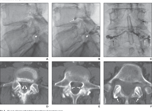The retrodural space of Okada. | Semantic Scholar