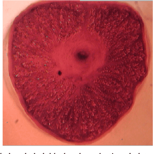 Figure 2 from A CASE OF NASAL MYIASIS DUE TO OESTRUS OVIS ( NASAL BOT ...