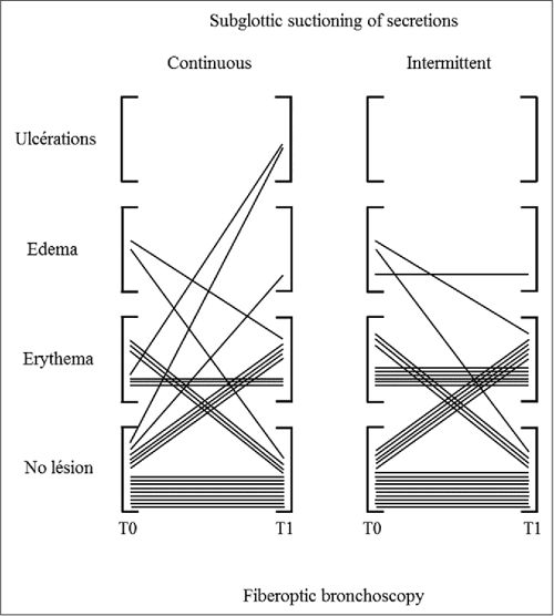 Figure 1 from Effect of Continuous versus Intermittent Subglottic ...