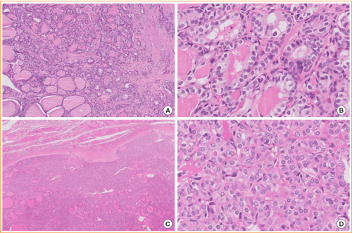 Table 1 from Update from the 2022 World Health Organization ...