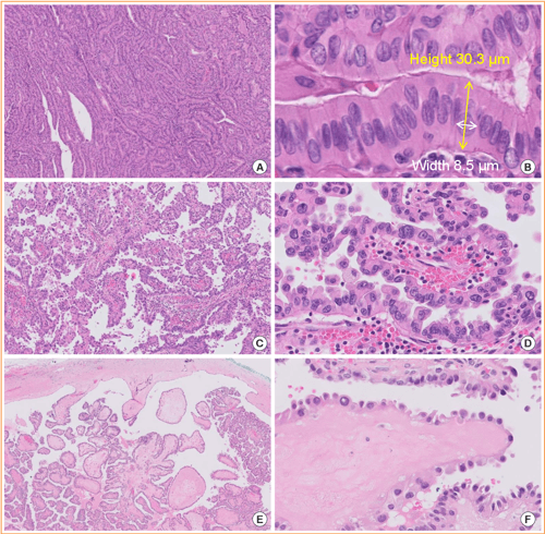 Table 1 from Update from the 2022 World Health Organization ...