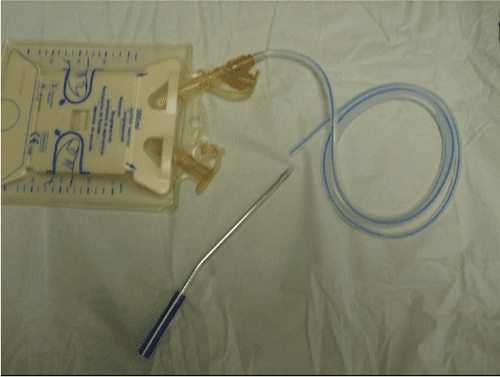 Figure 3 from Surgical vacuum drains: types, uses, and complications ...