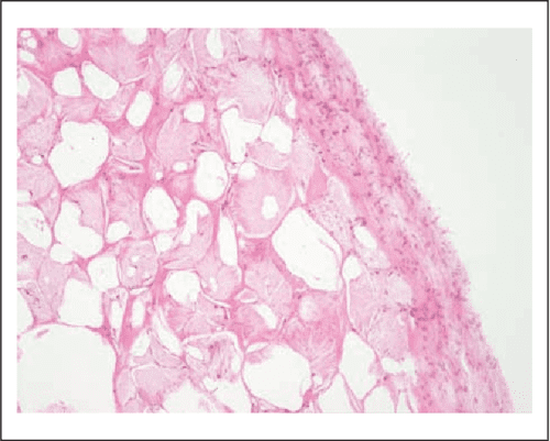 Figure 6 from Mobile Encapsulated Adipose Tissue (MEAT) of Cows and ...