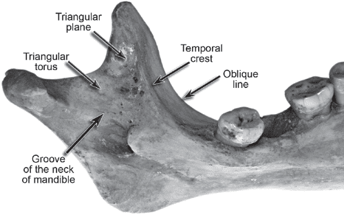 Figure 1 from Anatomy of the pterygomandibular space - clinical ...
